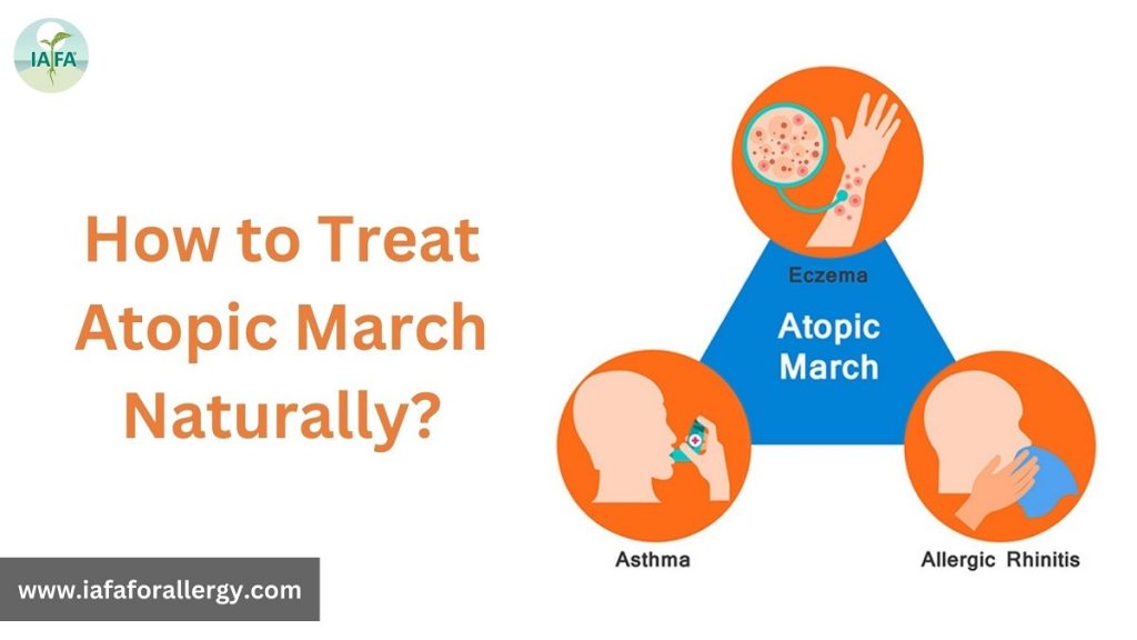 What is Atopic March and How to Treat It?